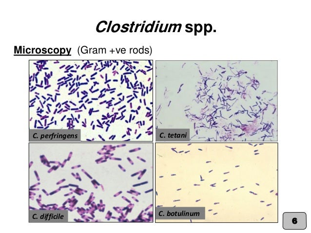 Clostridium spp. (Practical Medical Microbiology, 13)
