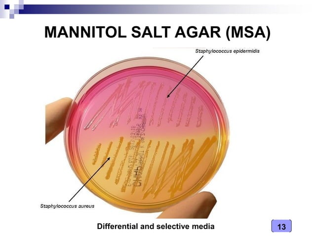 L13 medical microbiology laboratory (staphylococcus spp.) | PDF | Ear ...