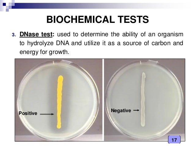 L13 medical microbiology laboratory (staphylococcus spp.)