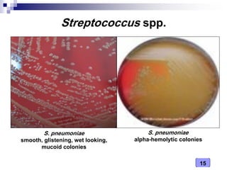 Streptococcus Pyogenes Colony Morphology