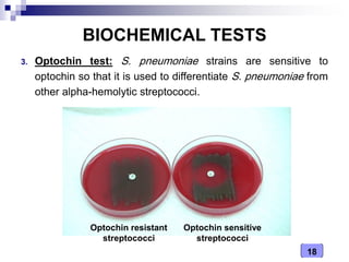 Optochin Test