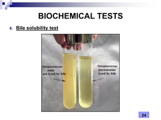 Bile Solubility Test