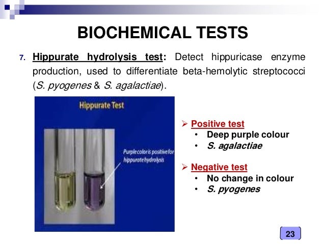 Medical Microbiology Laboratory (streptococcus spp.)