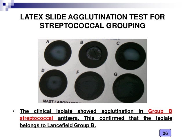 Medical Microbiology Laboratory (streptococcus spp.)