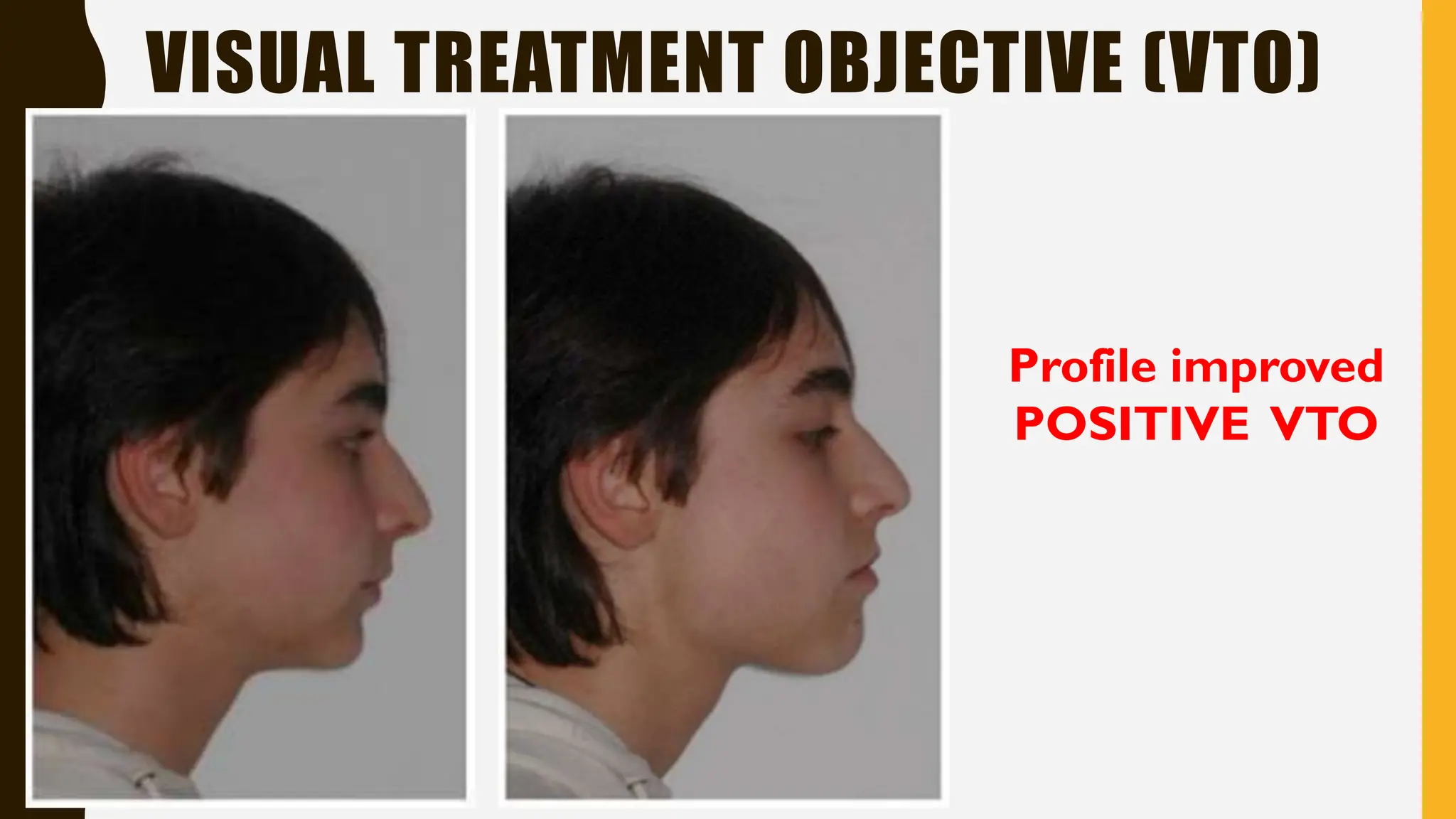 L14 Functional Appliances in orthodontics | PDF