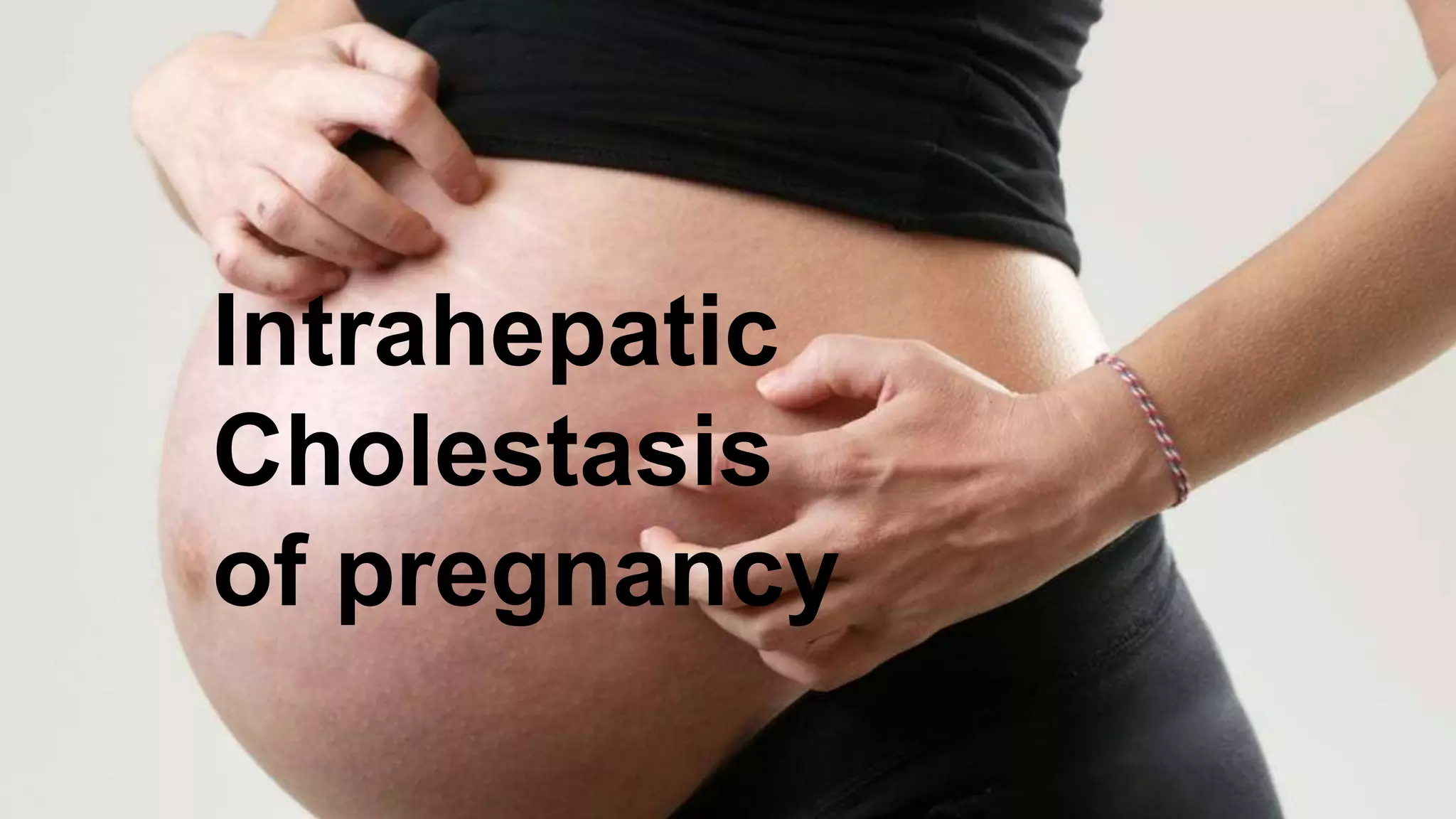 L25 Intrahepatic Cholestasis of pregnancy | PPTX
