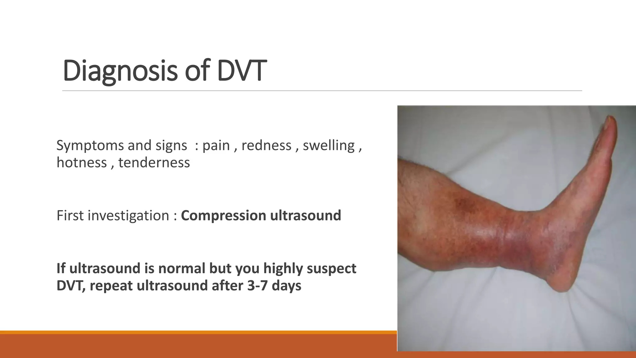 L27 Venous thromboembolism | PPTX