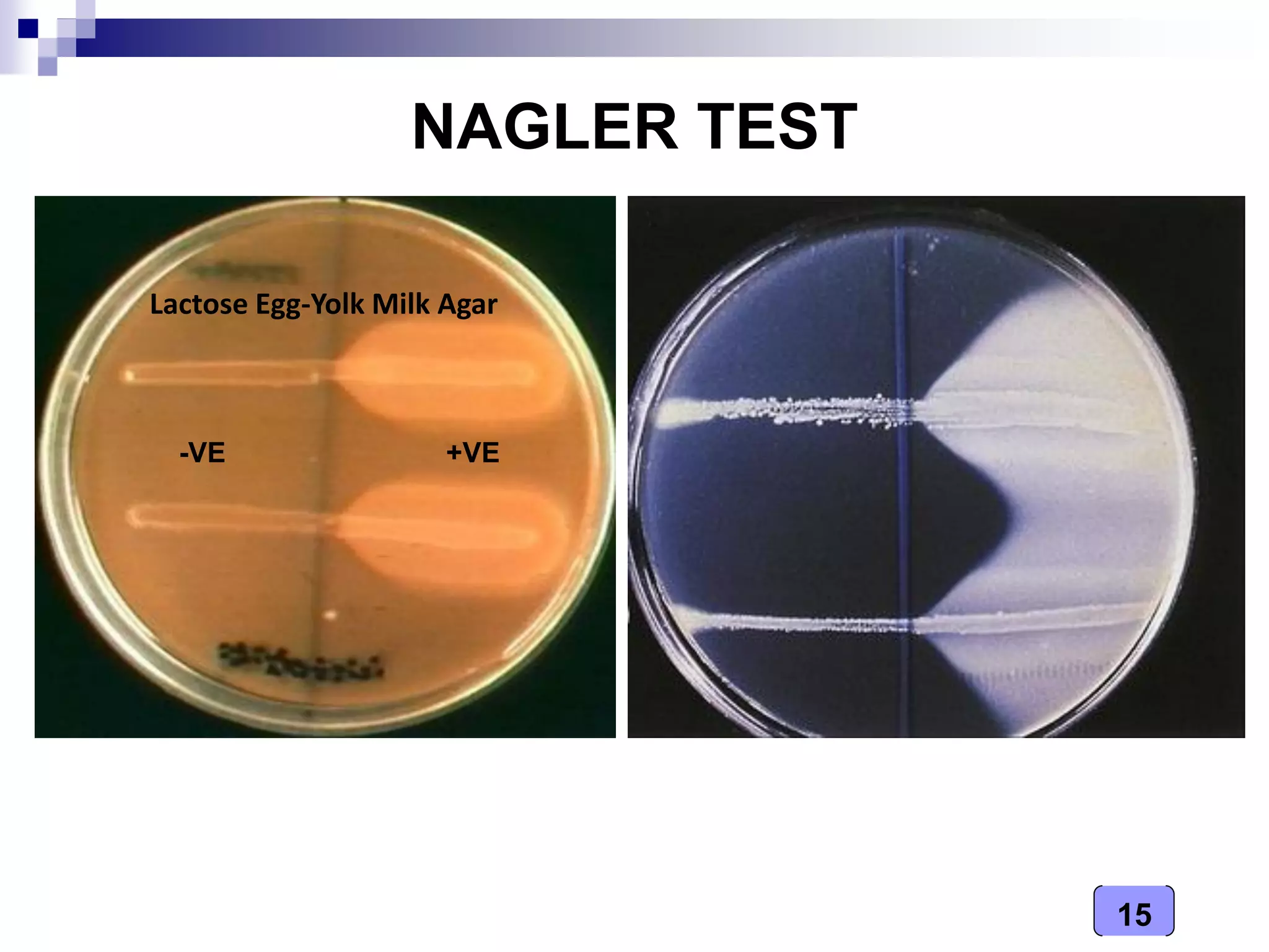 Medical Microbiology Laboratory (Clostridium spp.) | PDF