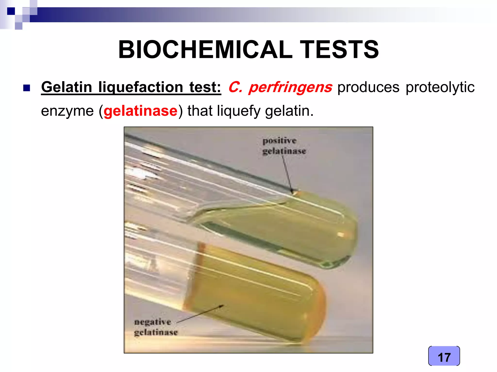 Medical Microbiology Laboratory (Clostridium spp.) | PDF