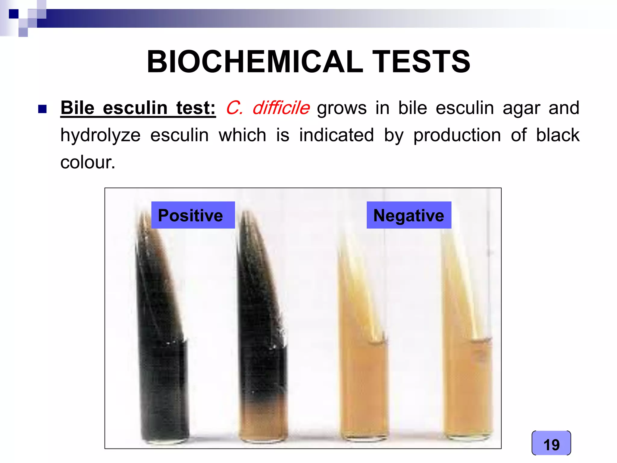 Medical Microbiology Laboratory (Clostridium spp.) | PDF
