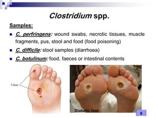 Medical Microbiology Laboratory (Clostridium spp.) | PDF