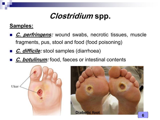 Medical Microbiology Laboratory (Clostridium spp.)