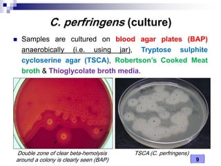 Clostridium Perfringens Colony