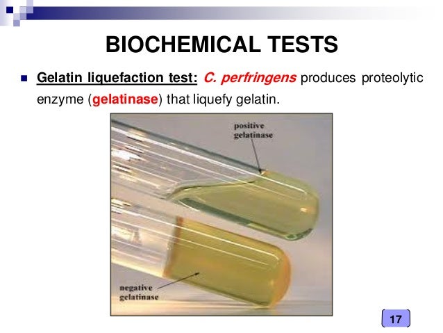 Gelatinase Production