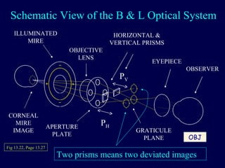 L15 chapter 13 keratometry and keratoscopy 2 2007 2008 | PPT