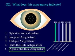 L15 chapter 13 keratometry and keratoscopy 2 2007 2008 | PPT