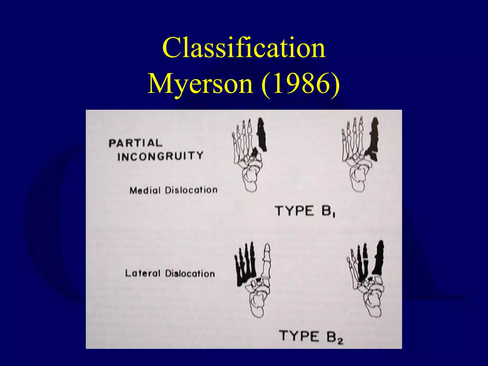 L16 lisfranc & midfoot inj | PPT