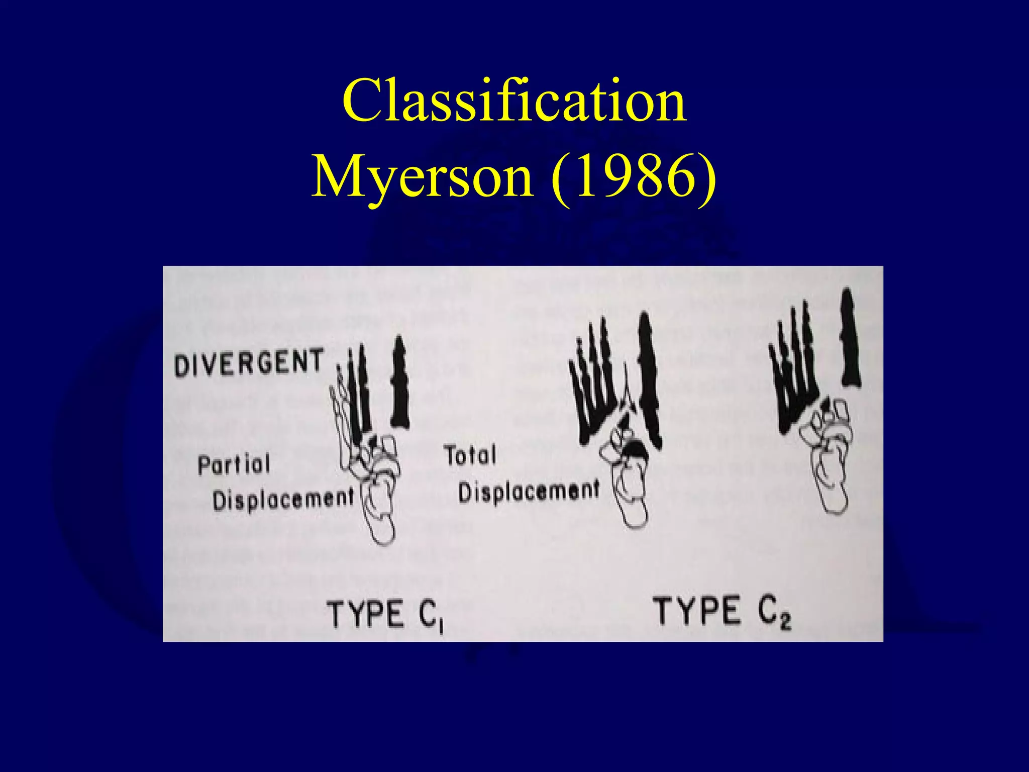 L16 lisfranc & midfoot inj | PPT