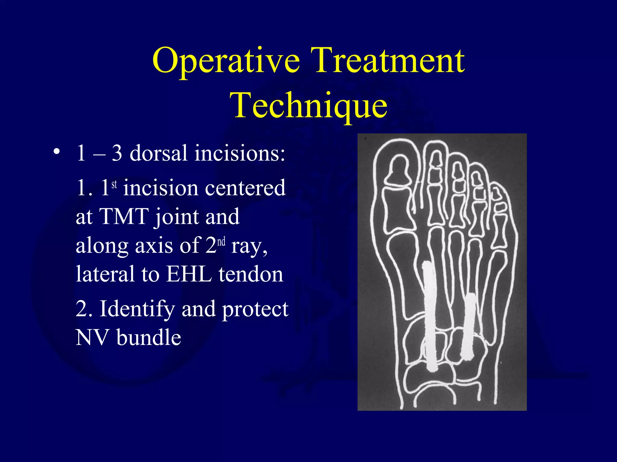 L16 lisfranc & midfoot inj | PPT