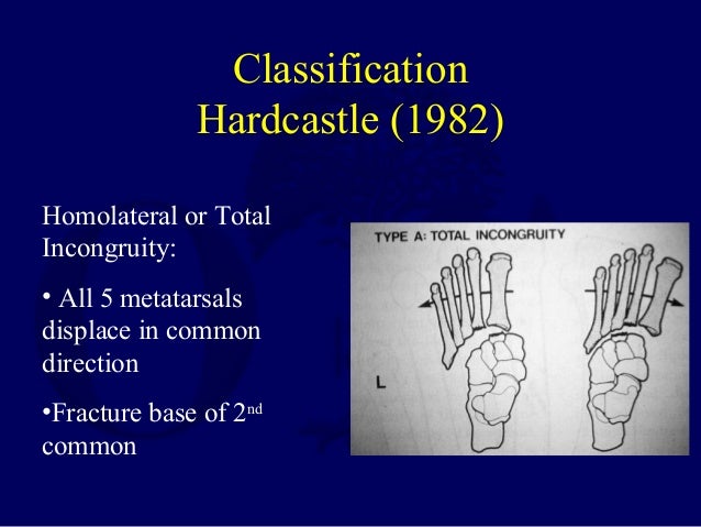 L16 lisfranc & midfoot inj
