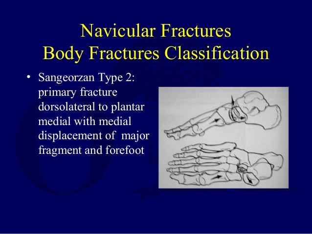 L16 lisfranc & midfoot inj
