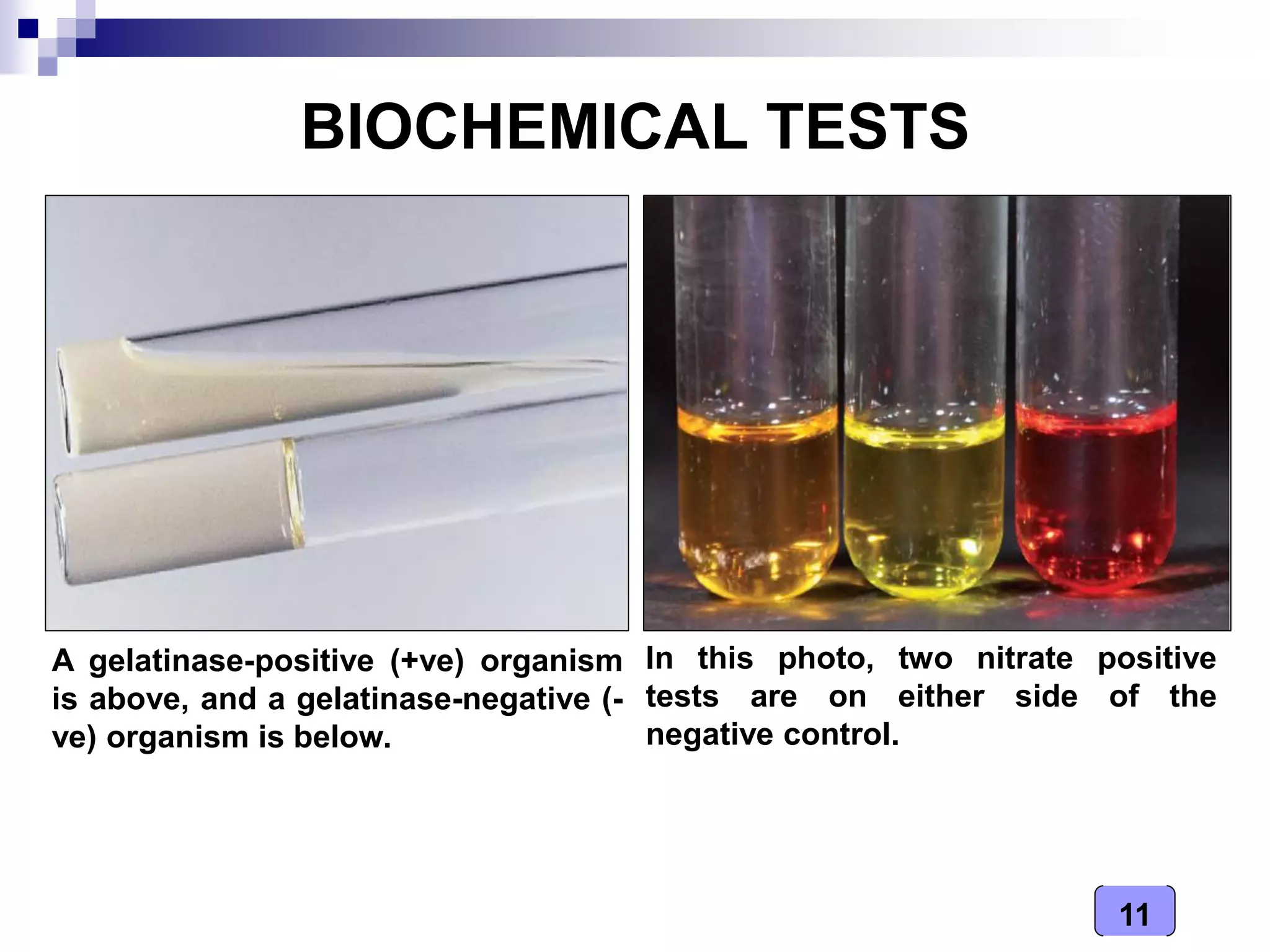 Medical Microbiology Laboratory (Bacillus spp.) | PDF