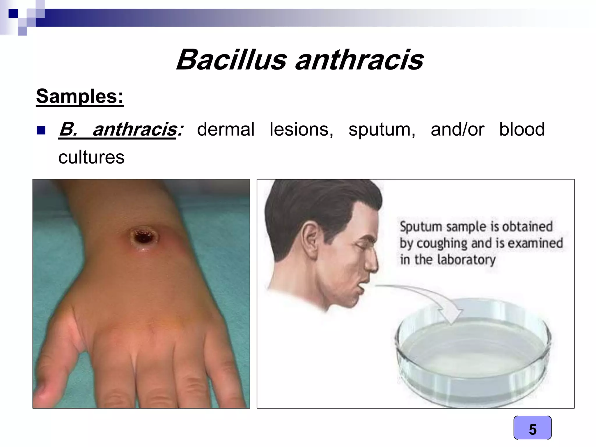 Medical Microbiology Laboratory (Bacillus spp.) | PDF