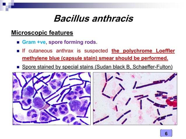 Medical Microbiology Laboratory (Bacillus spp.) | PDF | Chemistry | Science