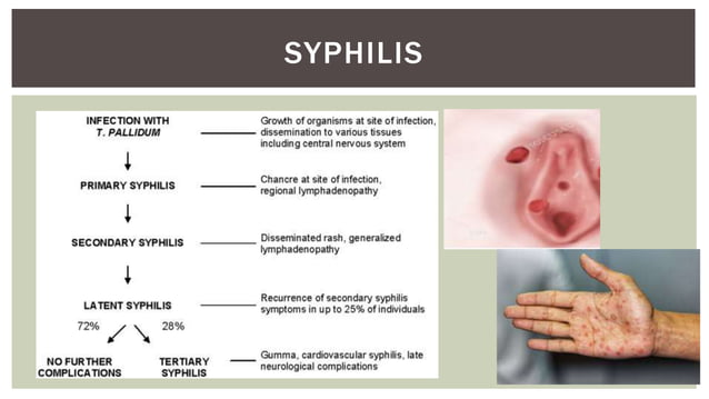 L29 Perinatal Infections part 1 | PPT