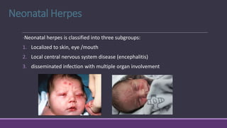L30 Perinatal Infections part 2 | PPTX