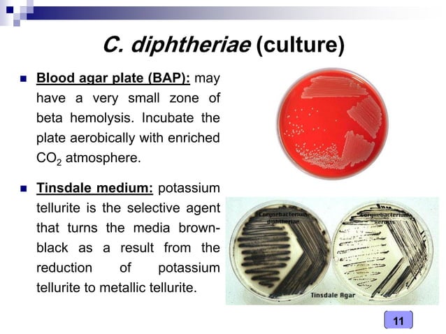 Medical Microbiology Laboratory (Corynebacterium and Listeria) | PPT