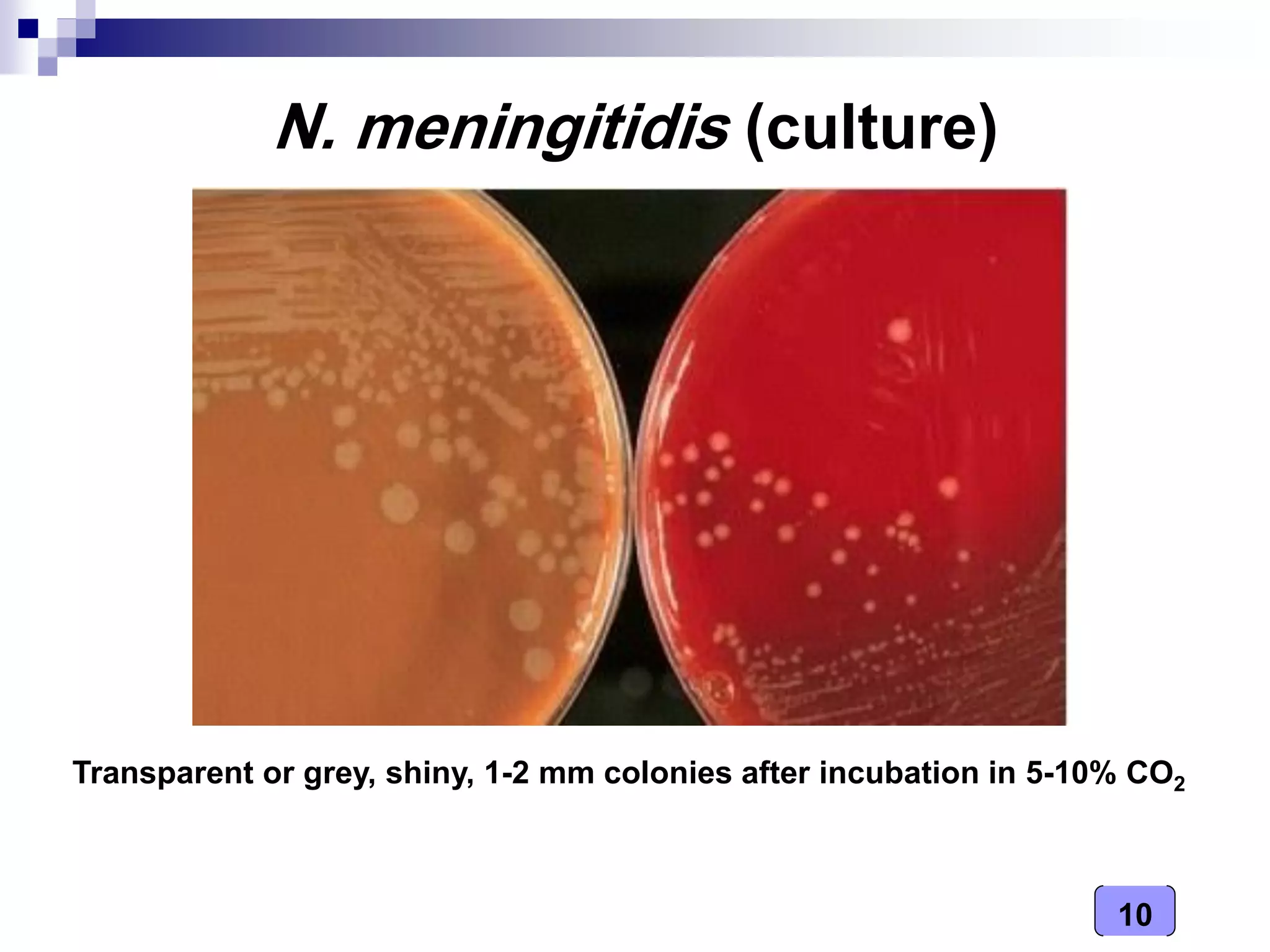 Medical Microbiology Laboratory (Neisseria spp.) | PDF