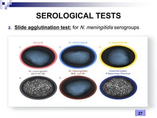 Medical Microbiology Laboratory (Neisseria spp.) | PDF