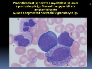 Proerythroblast Vs Promyelocyte