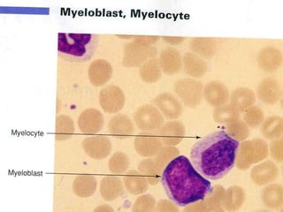 Myeloblast