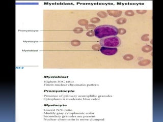Promyelocyte Vs Myelocyte