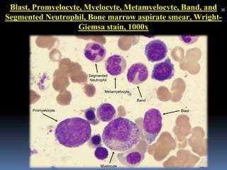 Myelocyte And Metamyelocyte