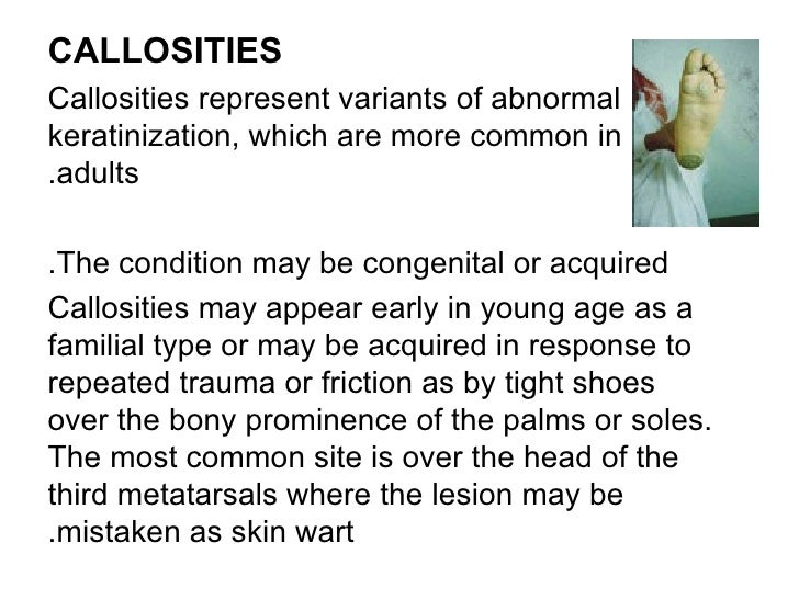 Dermatology 5th year, 2nd lecture (Dr. Kazhan)