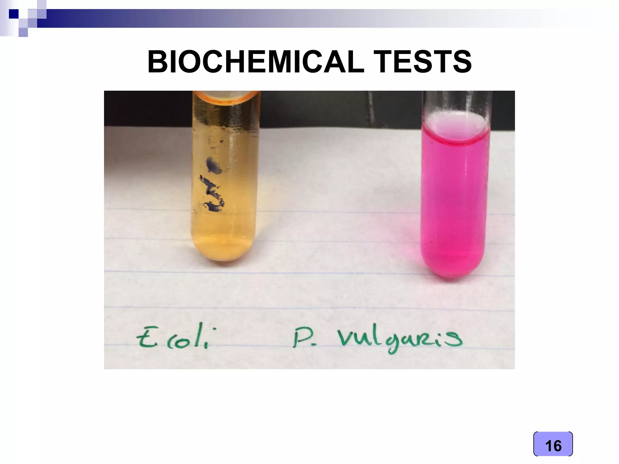 Medical Microbiology Laboratory (Enterobacteriaceae - i) | PDF