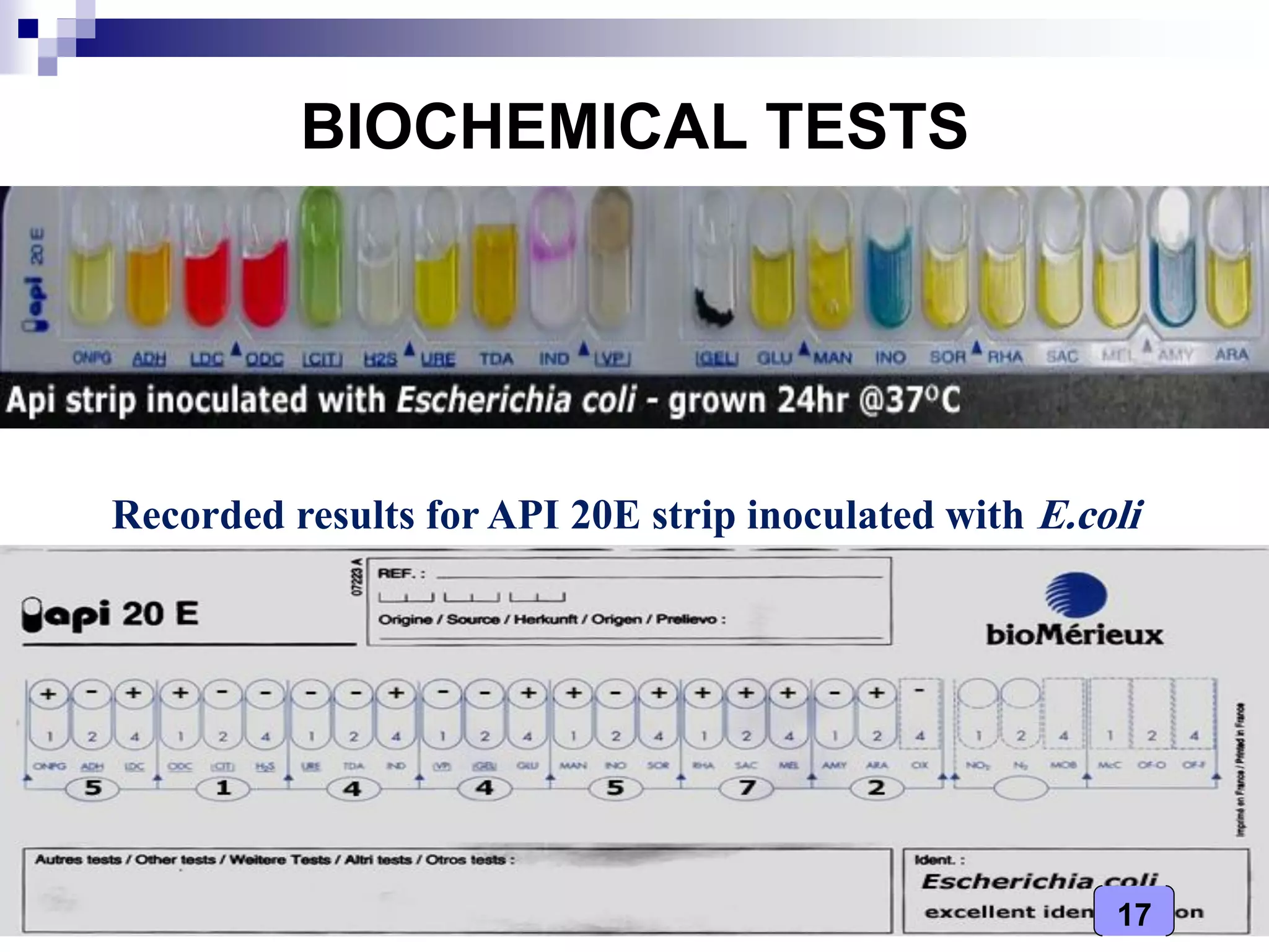 Medical Microbiology Laboratory (Enterobacteriaceae - i) | PDF