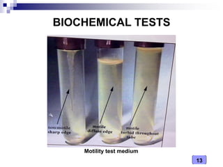 Medical Microbiology Laboratory (Enterobacteriaceae - i) | PPT