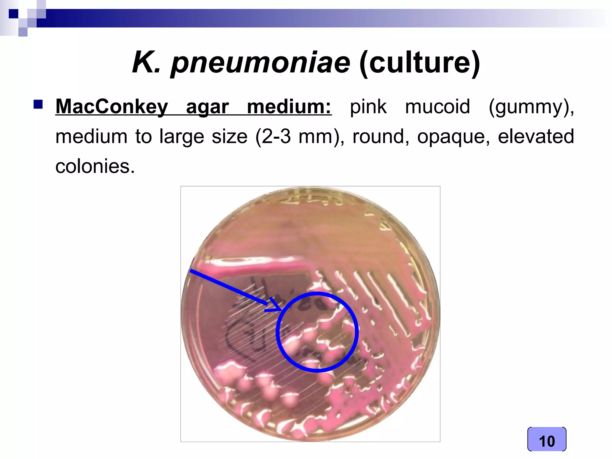 Medical Microbiology Laboratory (Enterobacteriaceae - II) | PDF