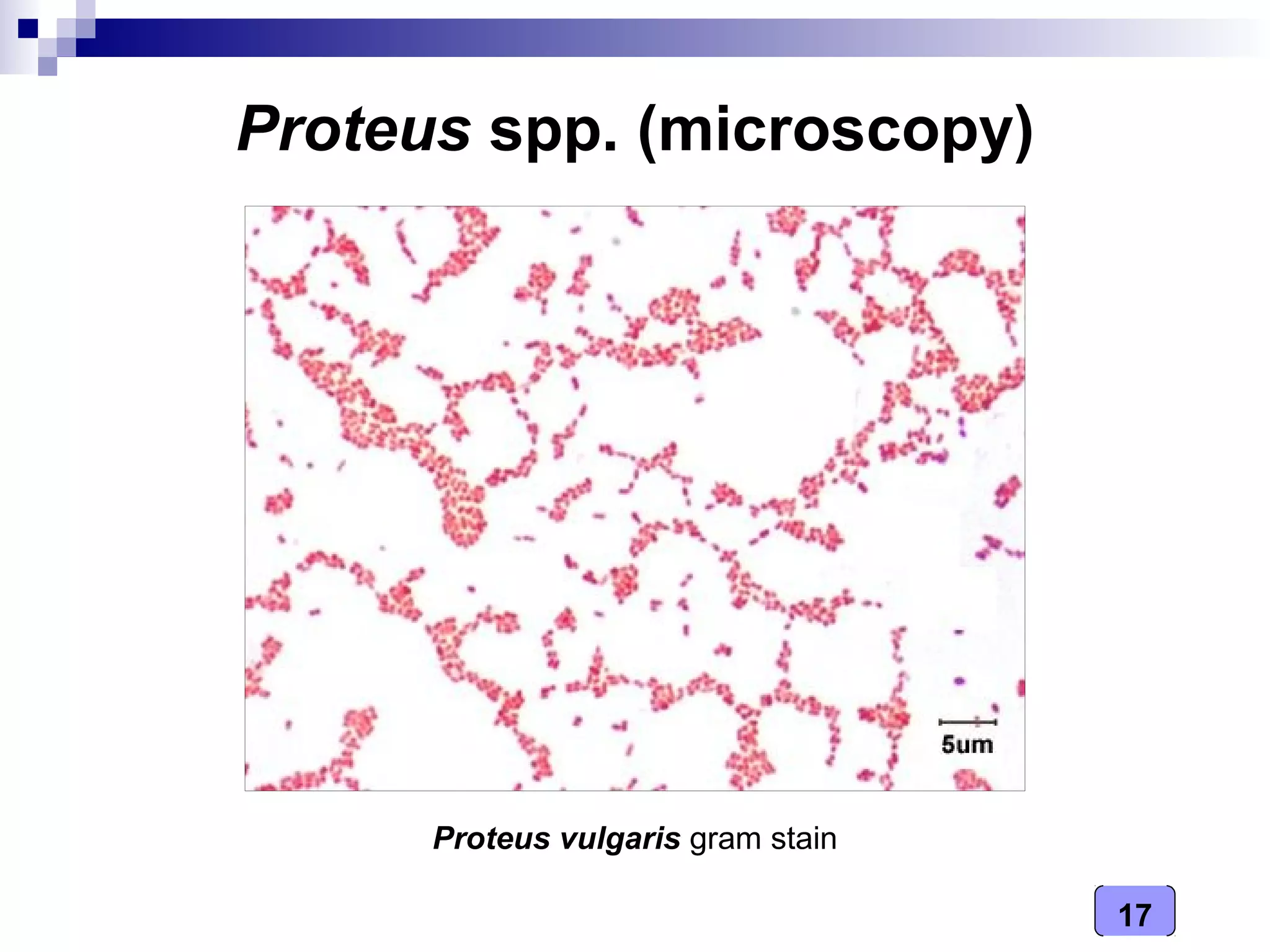 Medical Microbiology Laboratory (Enterobacteriaceae - II) | PDF