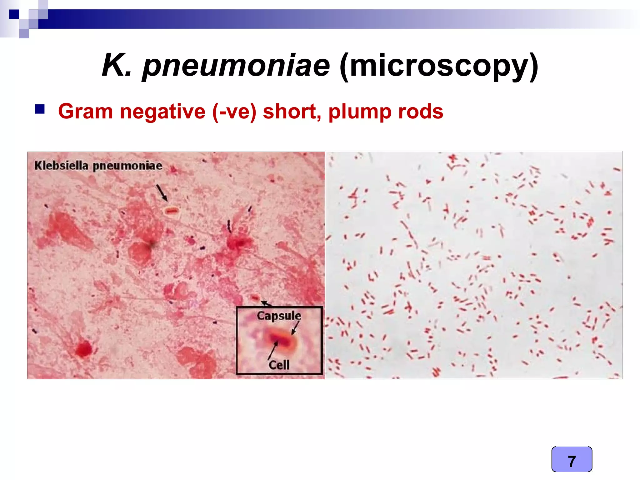 Medical Microbiology Laboratory (Enterobacteriaceae - II) | PDF