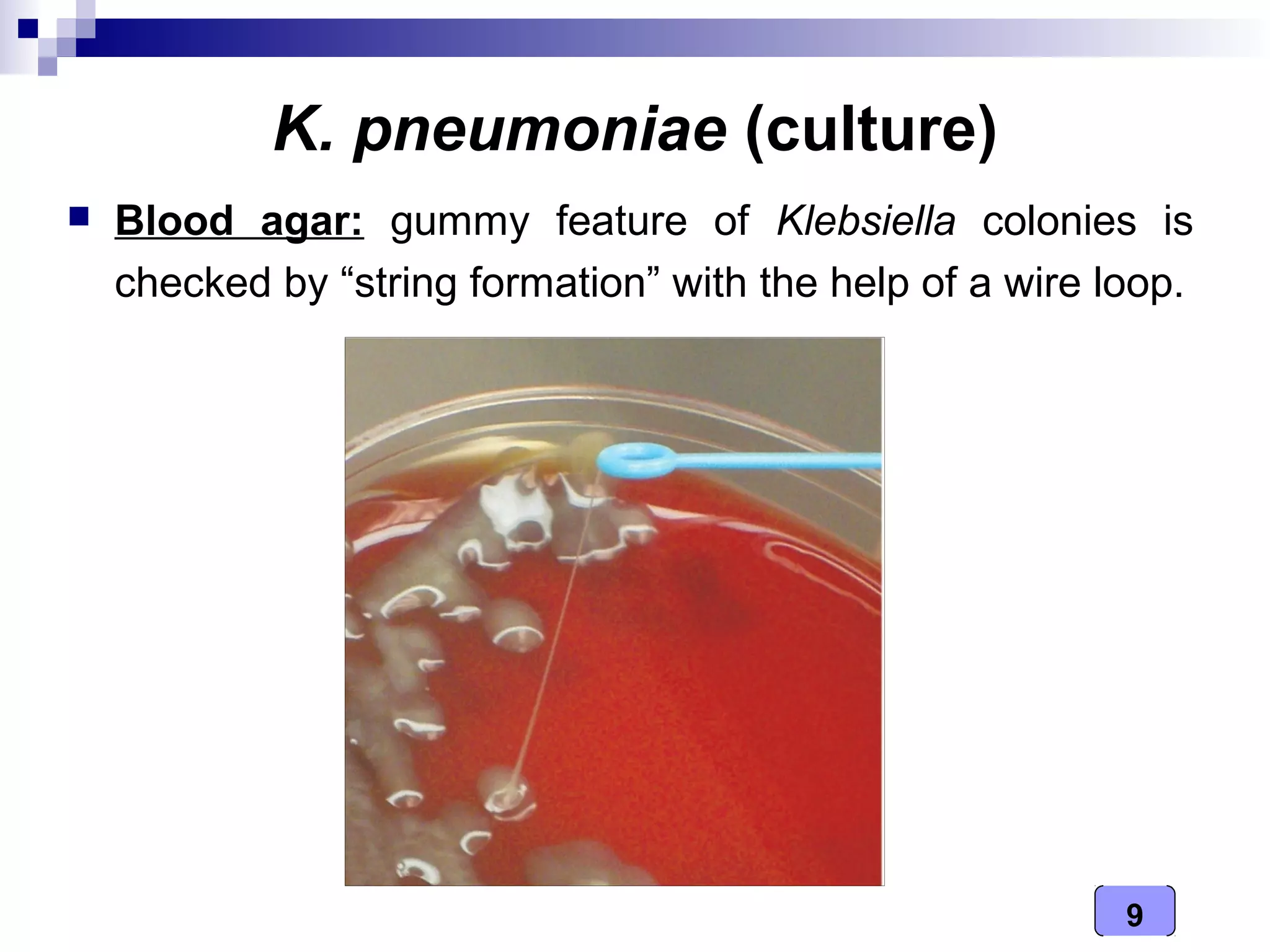 Medical Microbiology Laboratory (Enterobacteriaceae - II) | PDF