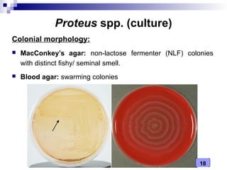 Medical Microbiology Laboratory (Enterobacteriaceae - II) | PDF