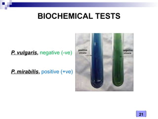 Medical Microbiology Laboratory (Enterobacteriaceae - II) | PDF