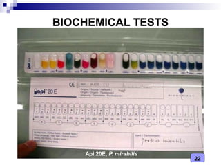 Medical Microbiology Laboratory (Enterobacteriaceae - II) | PDF