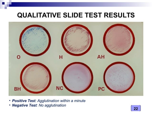 Medical Microbiology Laboratory (Enterobacteriaceae - III) | PPT