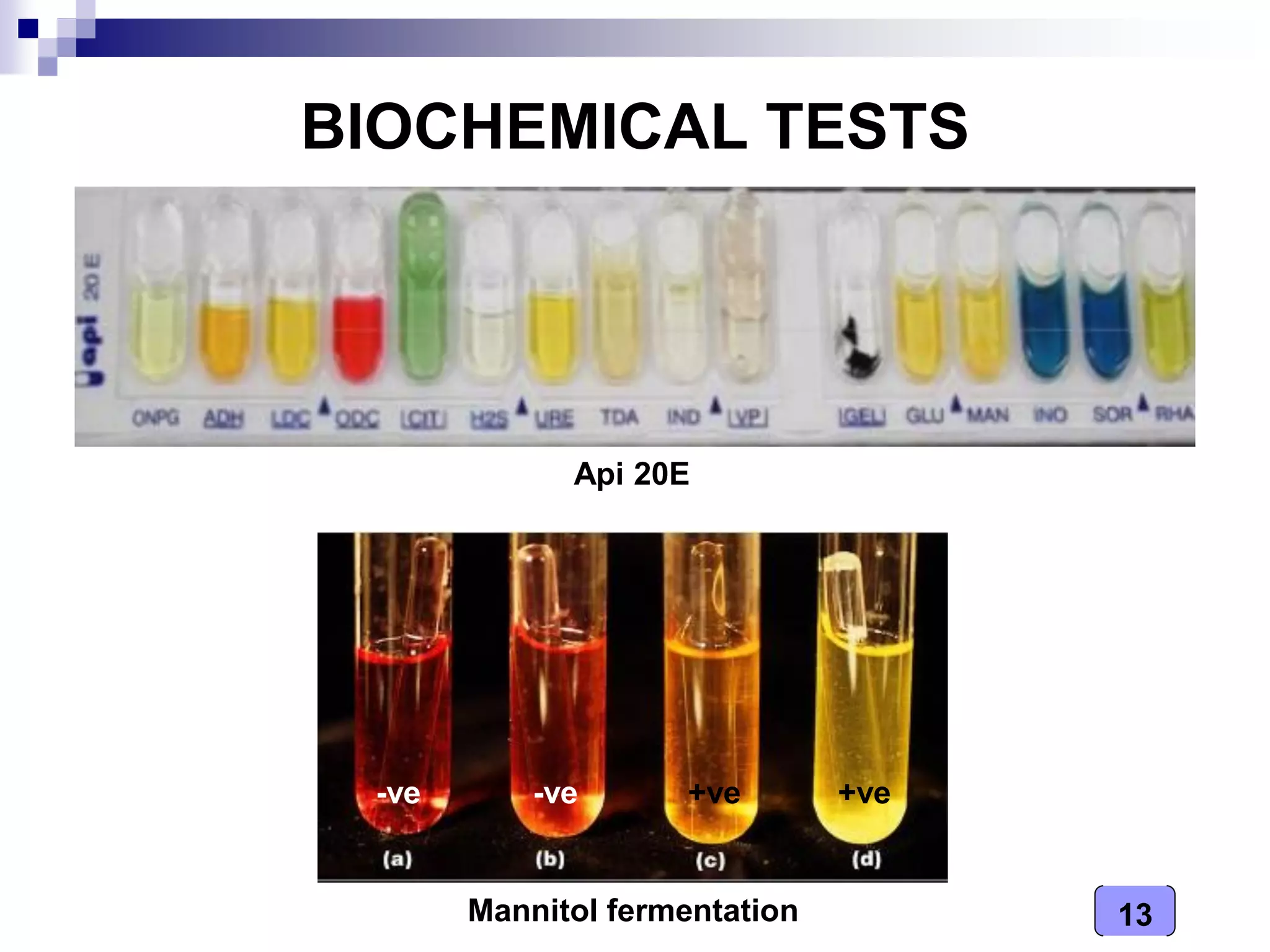 Medical Microbiology Laboratory (Enterobacteriaceae - IV) | PPT